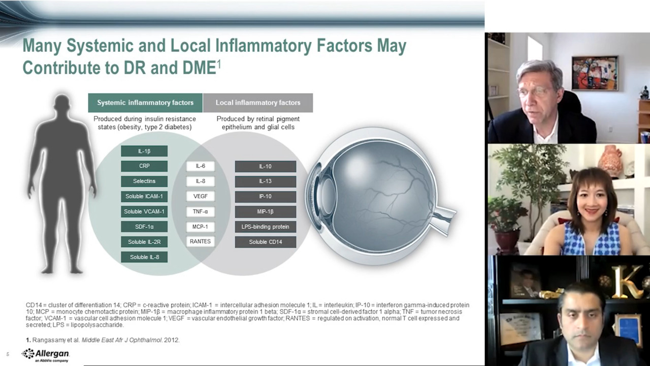 Diabetic Macular Edema Pathophysiology