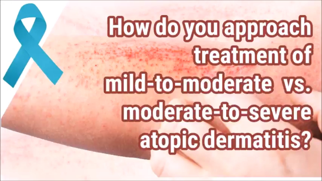 Mild Atopic Dermatitis In Adults