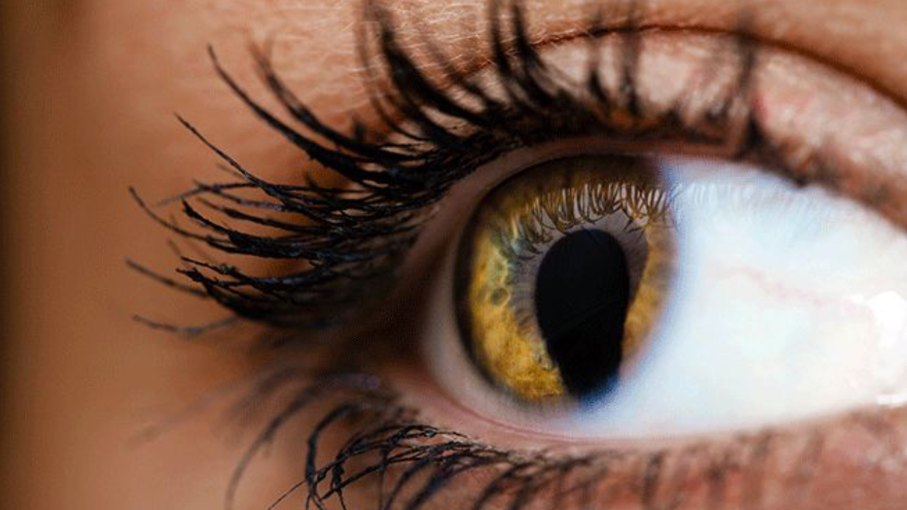 Raising awareness of cat eye syndrome – Breakfast Television