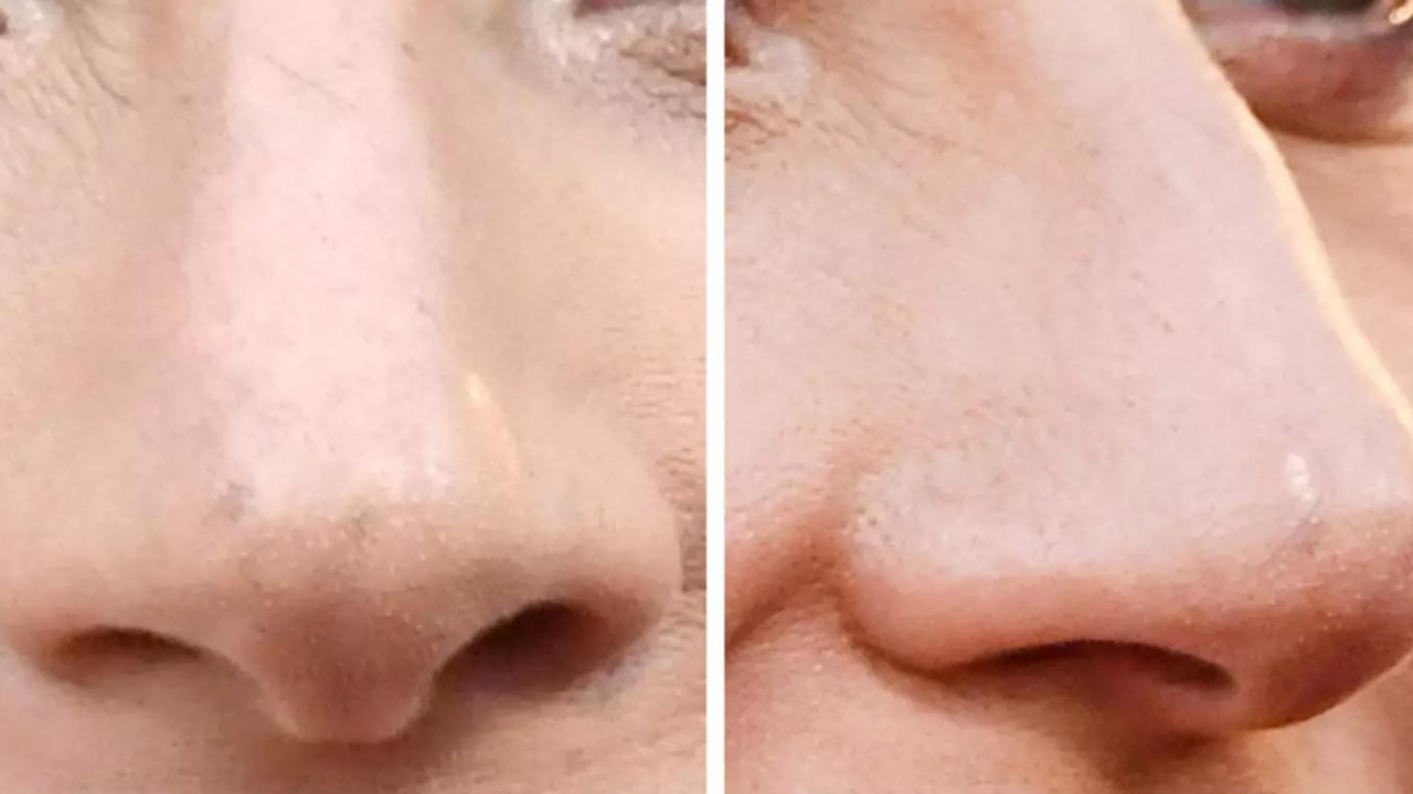 Can YOU guess which celebrities these noses belong to? – Breakfast ...