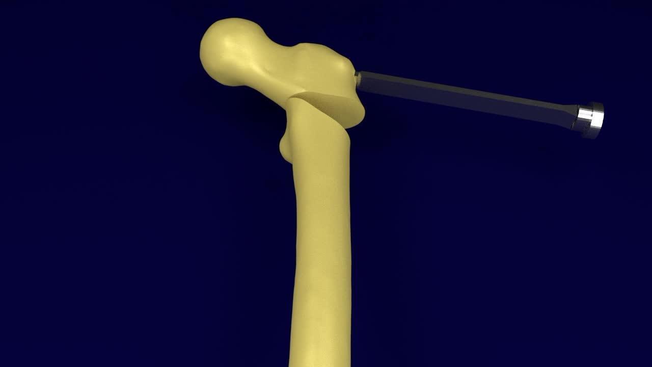 JBJS Orthopaedic Surgical Procedures