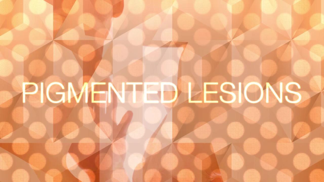 SPLENDOR X by Lumenis introduces BLEND X Technology - Video - RealSelf