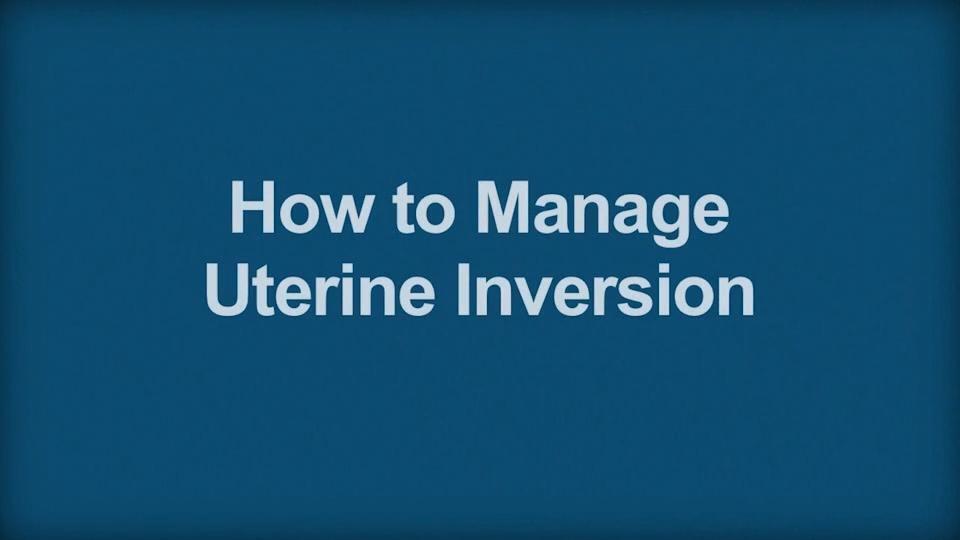 Uterine Inversion - Uterine Inversion - MSD Manual Professional Edition