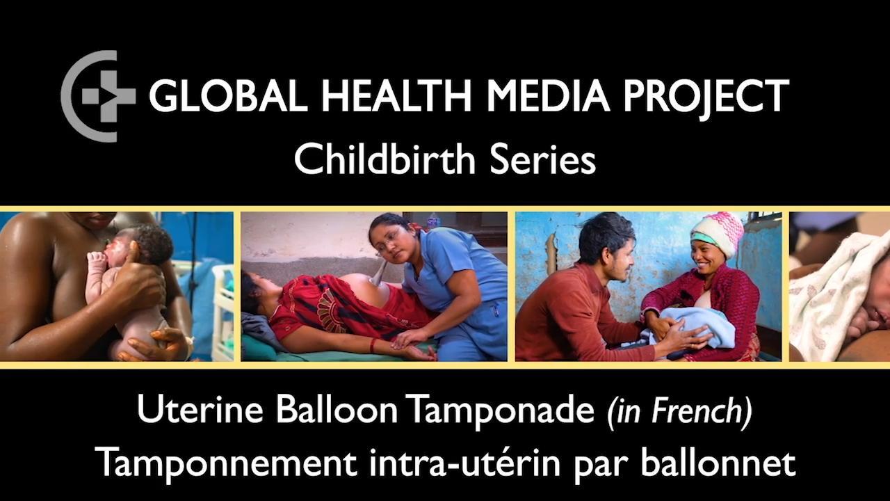 Hémorragies du post-partum - Hémorragies du post-partum - Édition ...