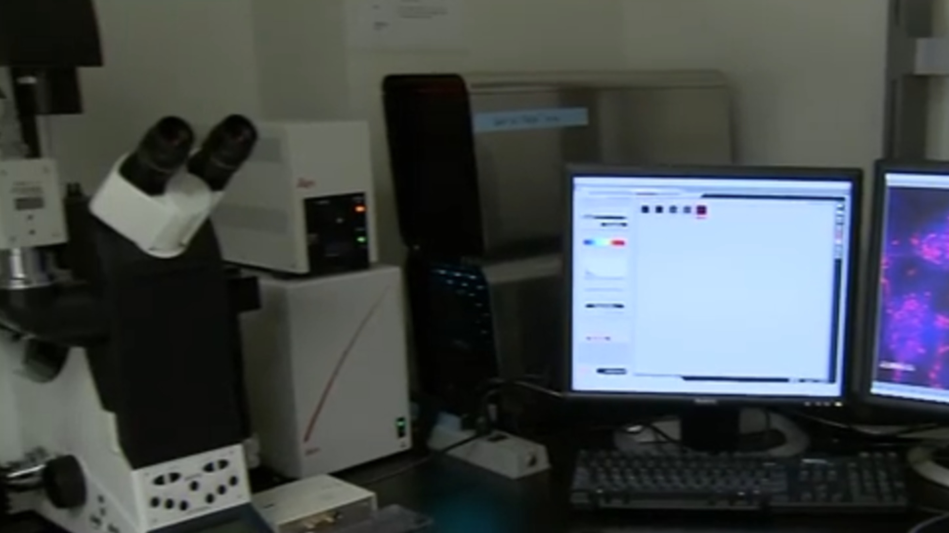 Why it's important to get genetically tested for Inherited Retinal Diseases