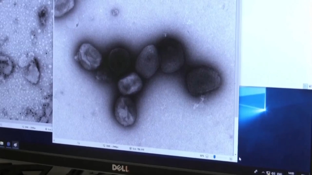 W.H.O. “not concerned” about a global monkeypox pandemic