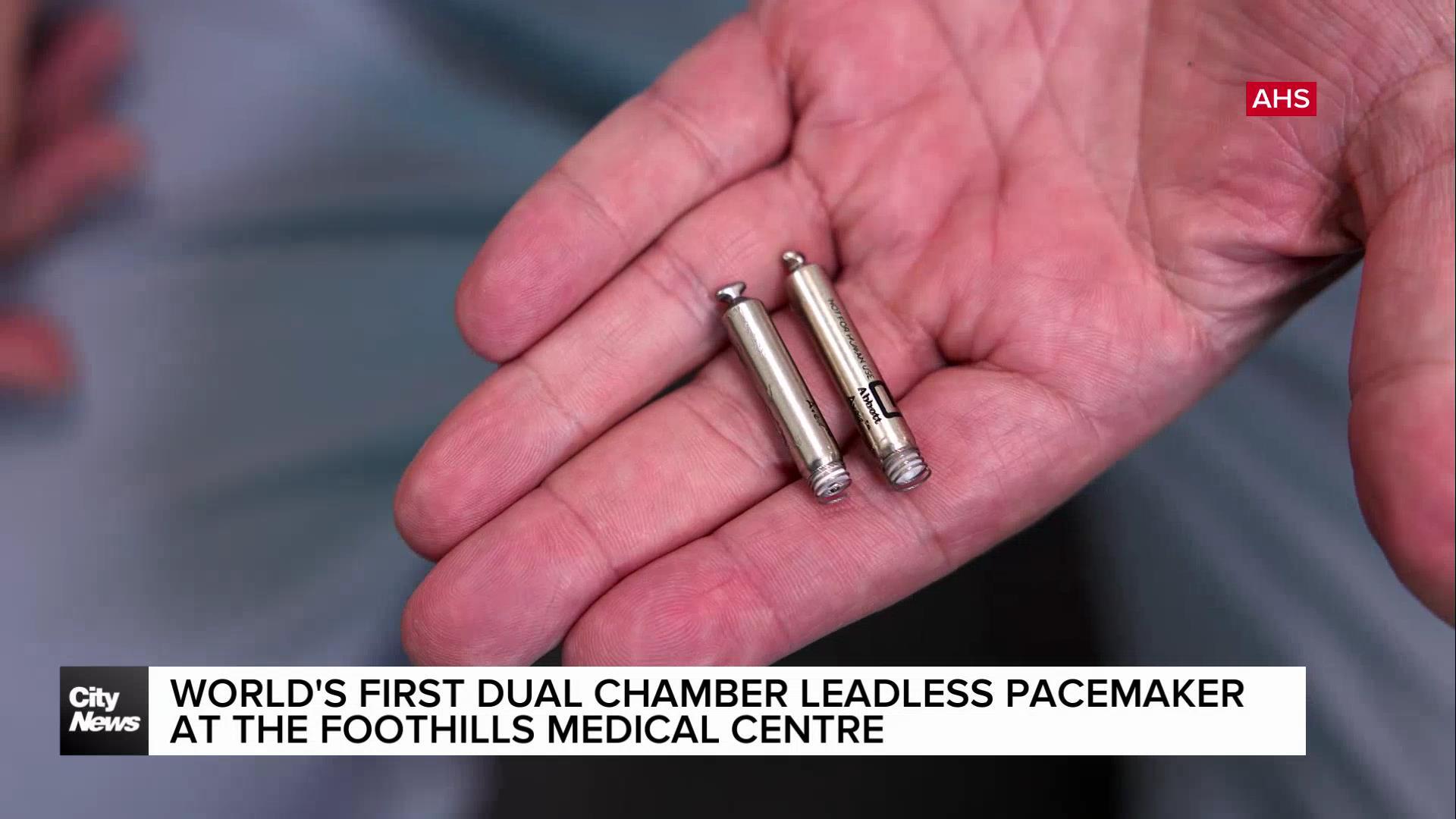World's first leadless, dual-chamber pacemaker being used in a Calgary ...