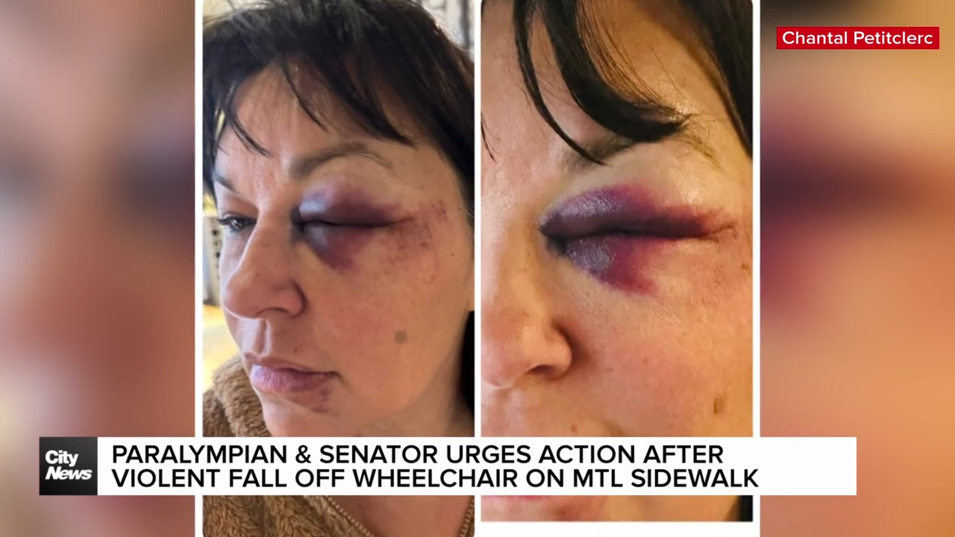 Russian attacks kill at least 7 in Ukraine