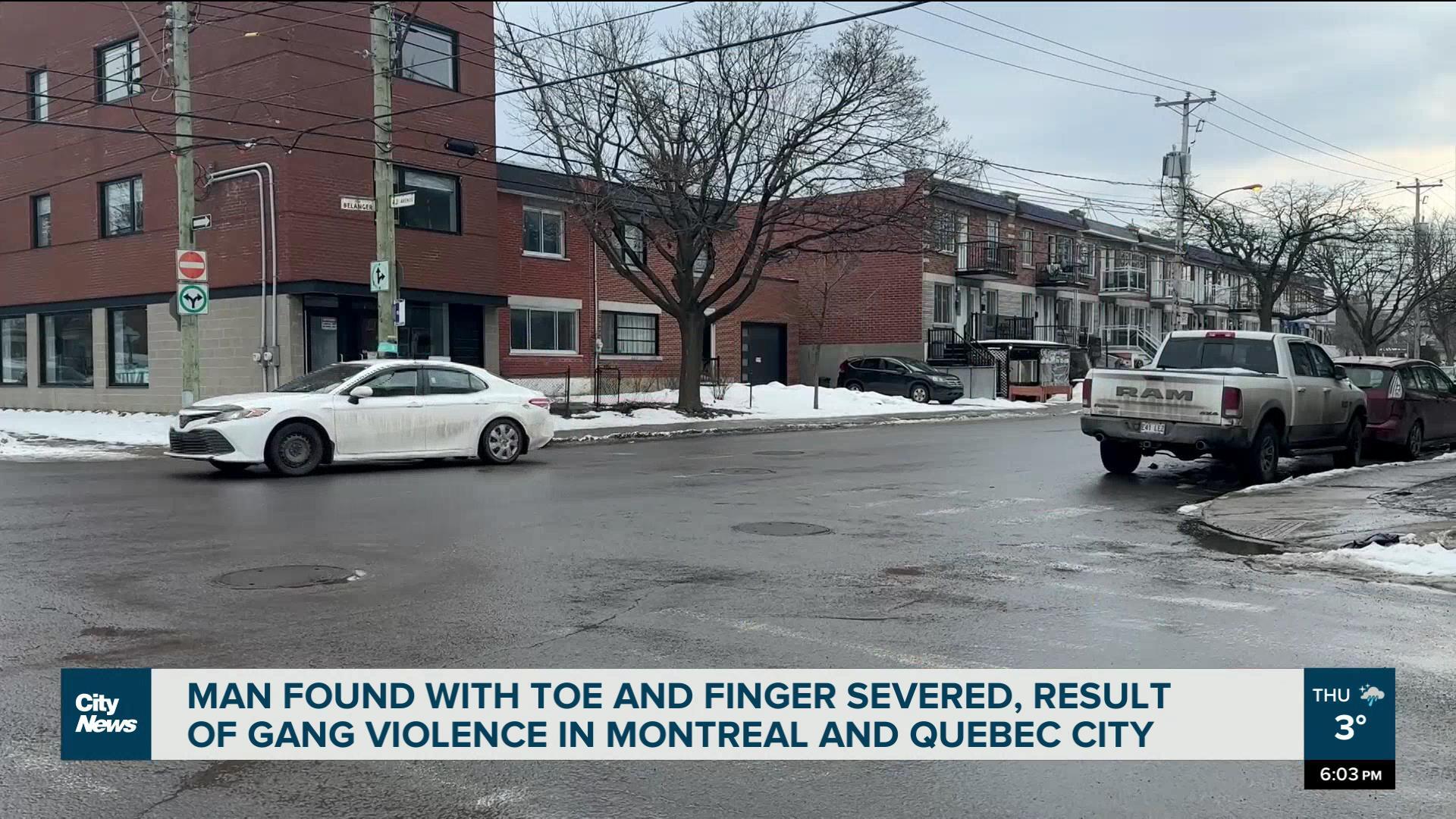 Street gang violence in Montreal: man's finger, toe severed