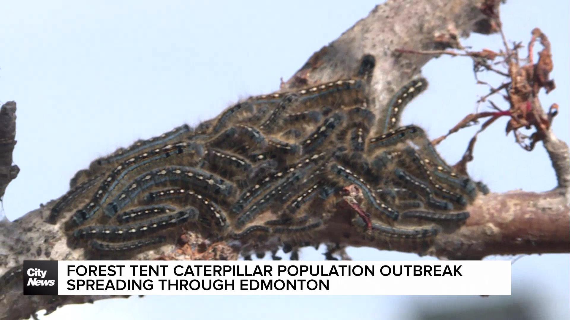 AHS confirms 2 measles cases in Edmonton