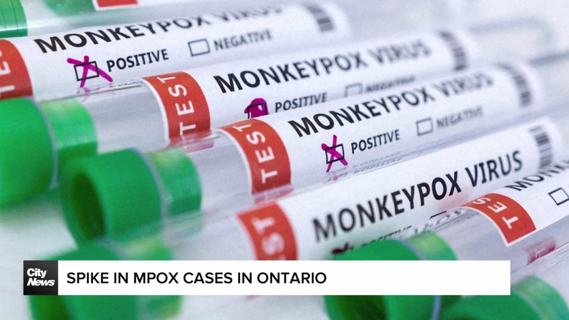 Ontario seeing rise in Mpox cases