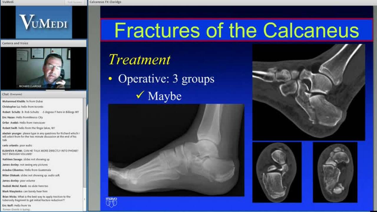 Calcaneus Fracture