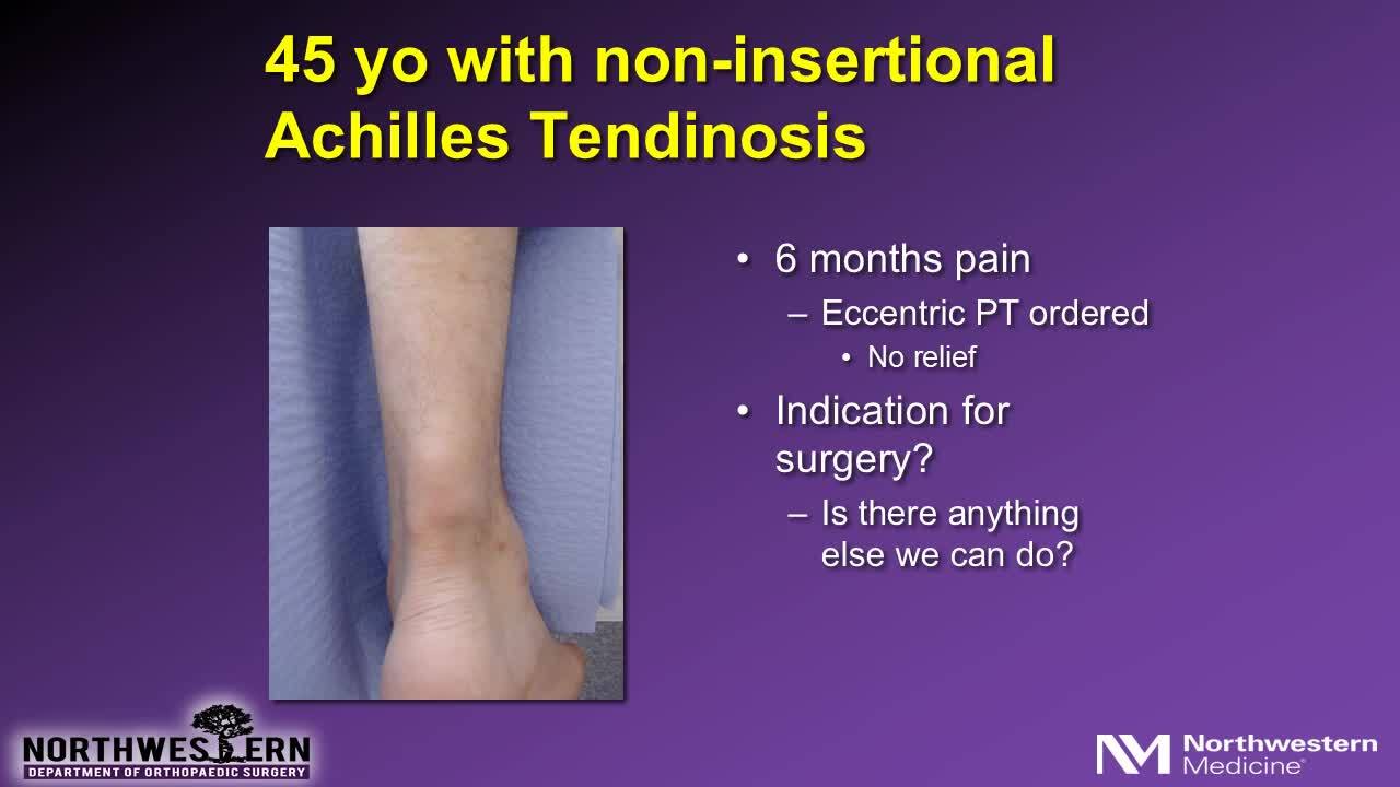Insertional Achilles Tendonitis