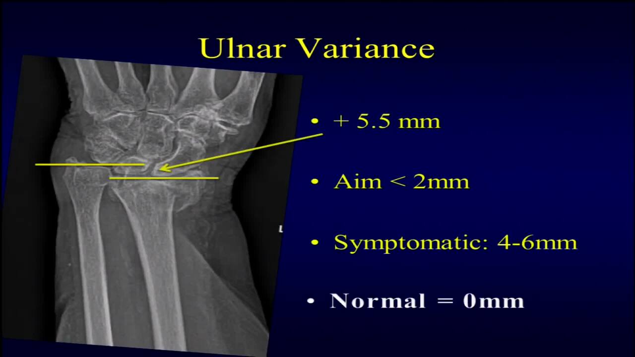 Distal Radius Anatomy
