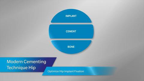 Optipac Vacuum Mixing System | Zimmer Biomet | Zimmer Biomet