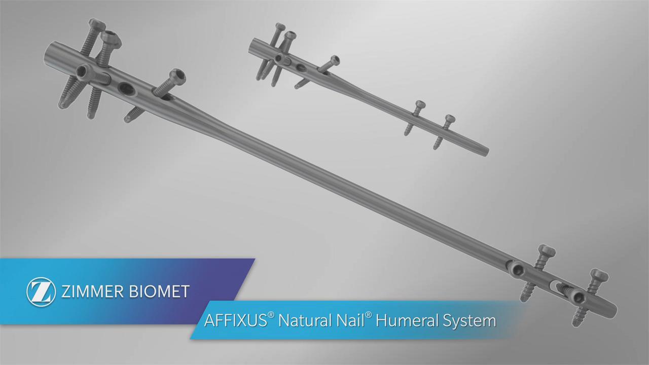 AFFIXUS Natural Nail Humeral System | Zimmer Biomet | Zimmer Biomet