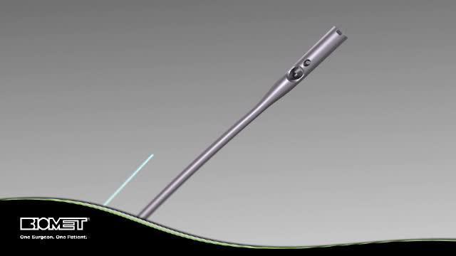 AFFIXUS Hip Fracture Nail System | Zimmer Biomet | Zimmer Biomet